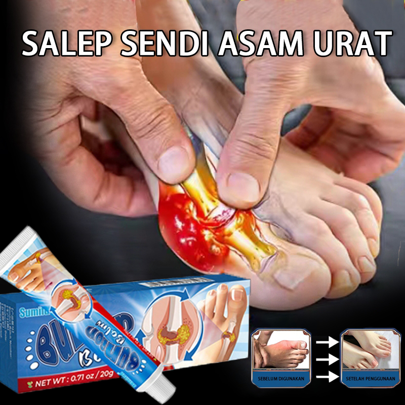 Jual Salep nyeri sendi gout, nyeri gout, nyeri sendi, pembengkakan ...