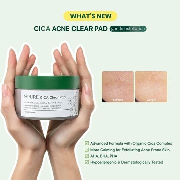 Jual NPURE Acne Clear Pad Cica / Kapas Eksfoliasi Kulit Jerawat 100 G.R ...