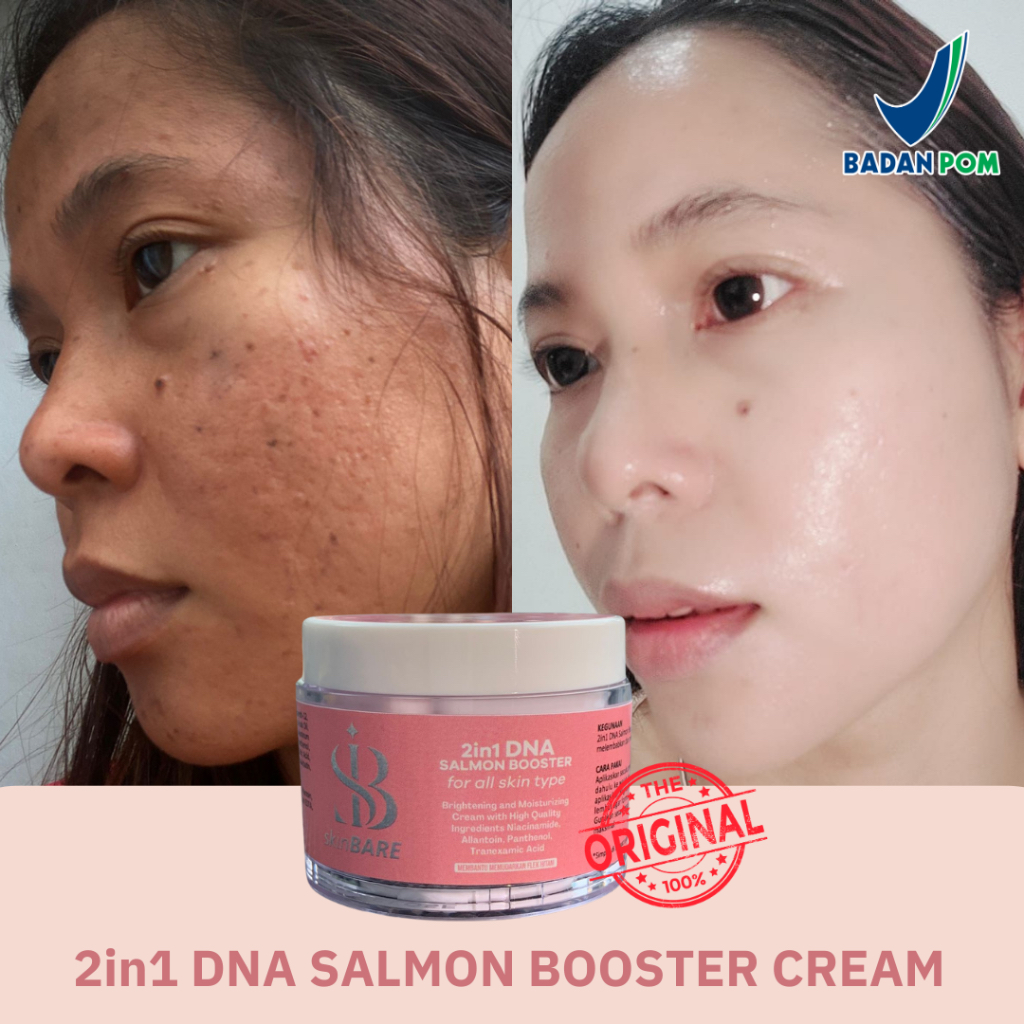 Jual [BPOM] 2in1 DNA Salmon Booster Cream | Booster & Krim DNA Salmon untuk Memudarkan Flek ...