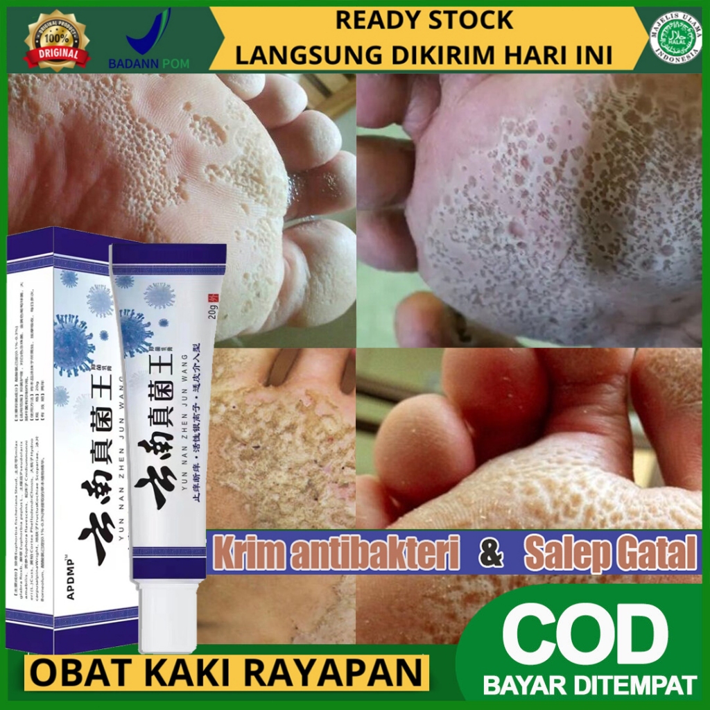 Jual ori Obat Kaki Rayapan Dan Bau Salep Cina Obat Gatal Krim ...