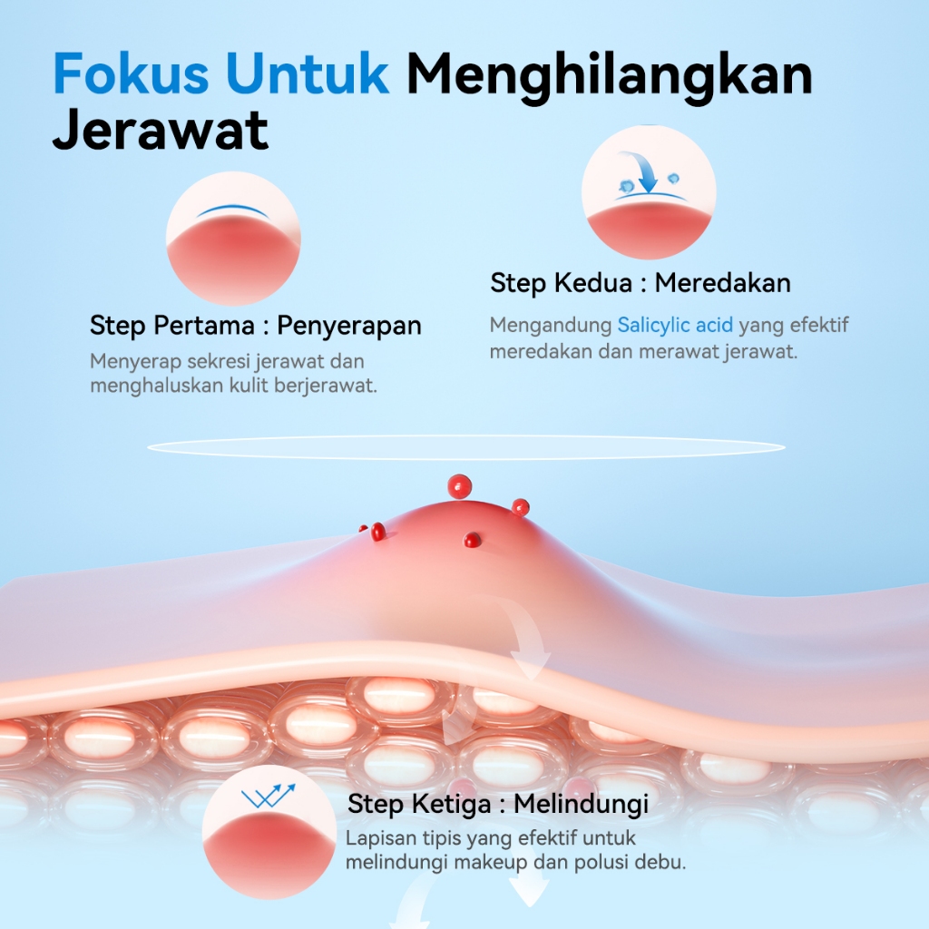 Jual FOCALSKIN Acne Cure Patch Pimple Patch Acne Spot / Sticker Jerawat ...