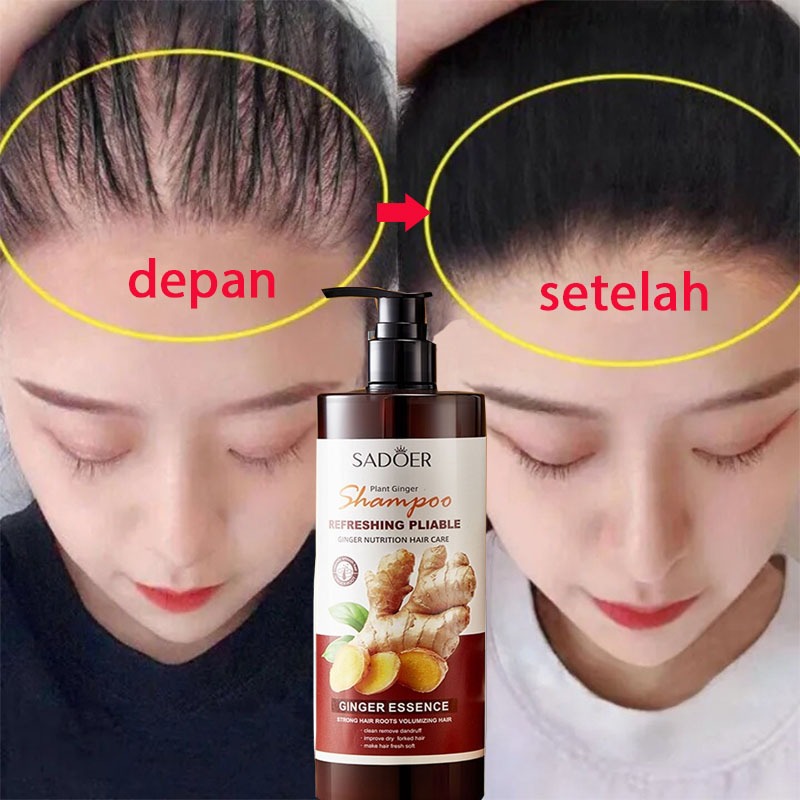 Jual Sampo Penumbuh Rambut Cepat Ginger Shampo 500ml pertumbuhan rambut Pengendalian Minyak Anti ...