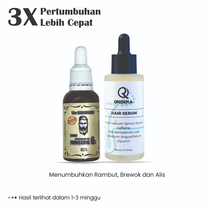 Jual Minoxidil TheRealBeard Dan Ordera Hair Serum menumbuhkan rambut ...