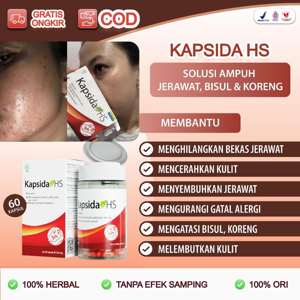 Jual Kapsida HS Botol Isi 60 Kapsul - Obat Jerawat Gatal-gatal Kulit ...