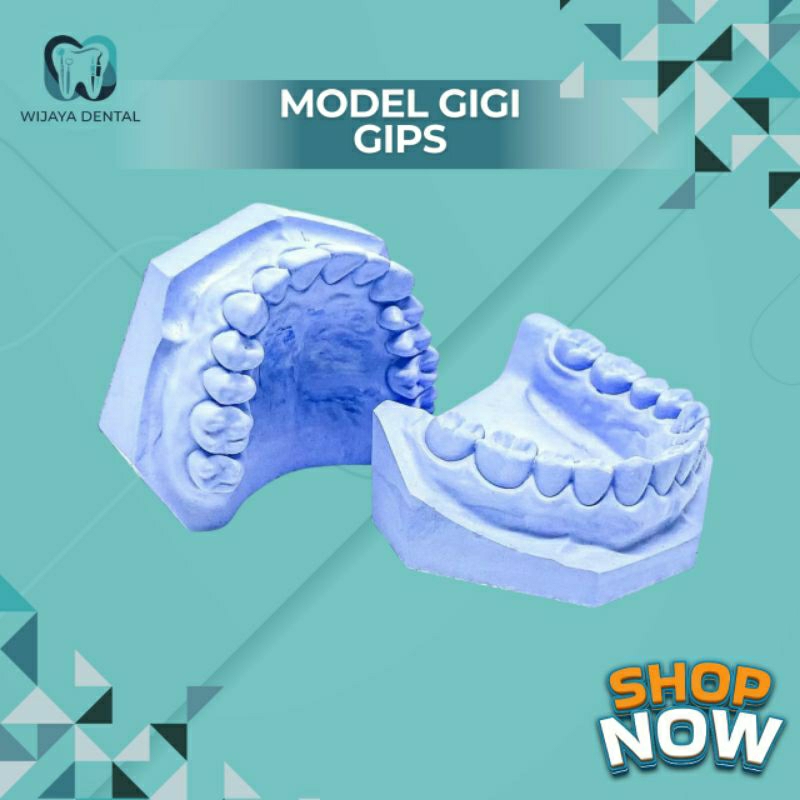 Jual DENTAL MODEL GIGI GIPS ATAS BAWAH / MODEL STUDY GIPS / MODEL GIGI ...