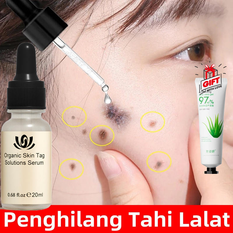 Jual Penghilang Tahi Lalat Penghilang Kutil Penghilang Tahi Lalat Di ...