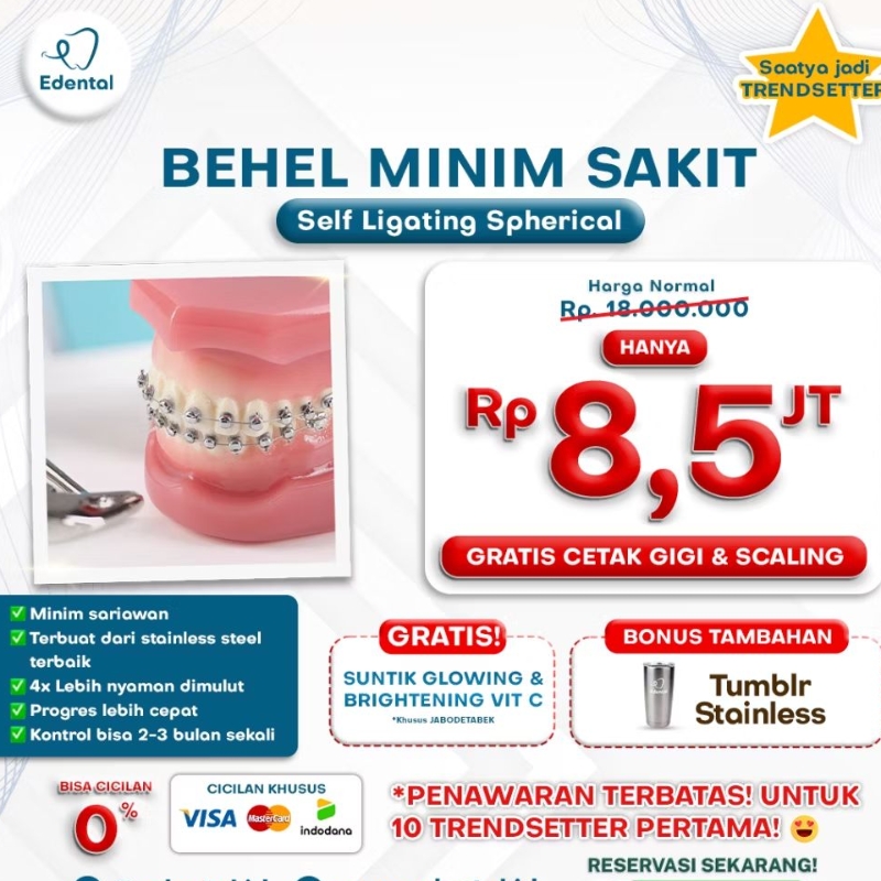 Jual Behel Metal Self Ligating | Shopee Indonesia