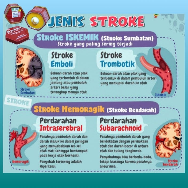 Jual ANGKUNG KALENG ASLI 100% OBAT HERBAL STROKE , PENDARAHAN ...