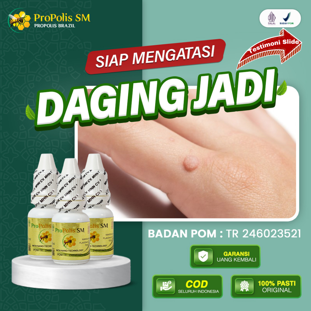 Jual Obat Daging Jadi Perontok Daging Tumbuh Kutil Skintag Bekas ...