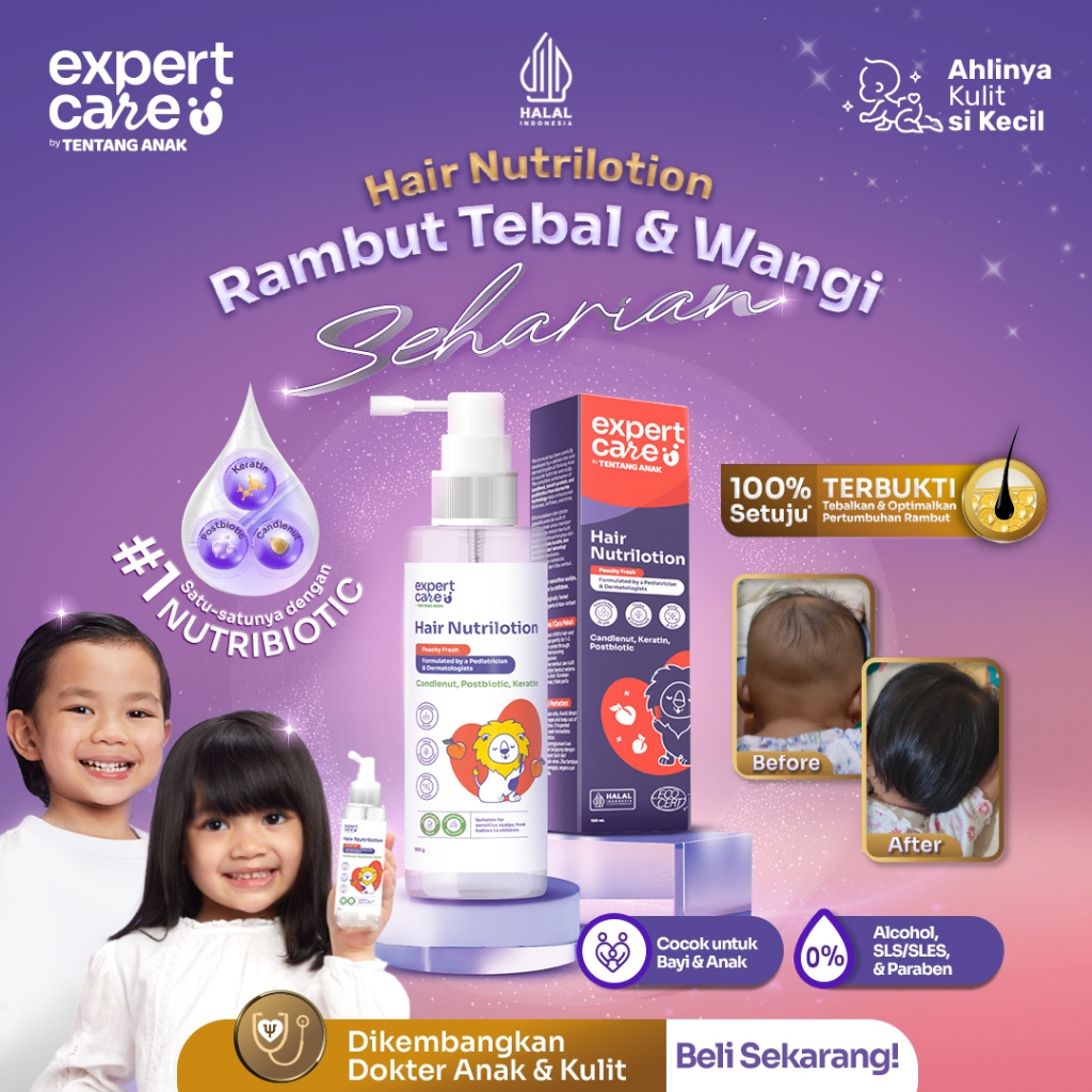 Jual Expert Care - Hair Nutrilotion 100ml - Hair Lotion Rambut Anak ...