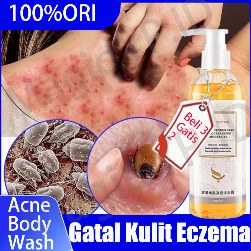 Jual sabun mandi cair sabun gatal sabun jerawat punggung sabun eksim ...