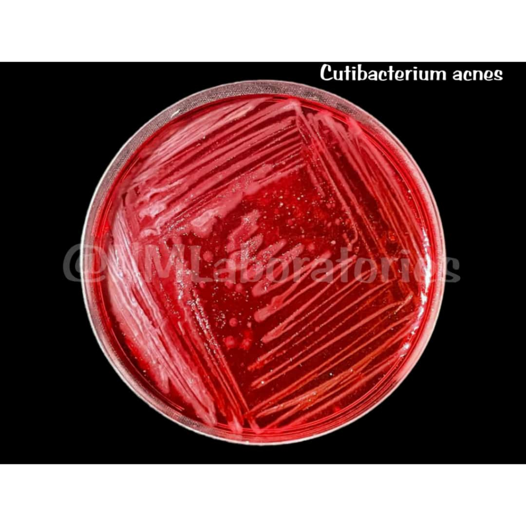 Jual Isolat bakteri Cutibacterium Acnes - C.acnes (media Blood Agar ...