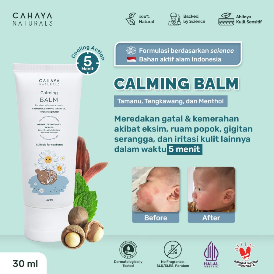 Jual Cahaya Naturals Calming Balm (Eczema & Rash Cream) 30ml | Shopee ...