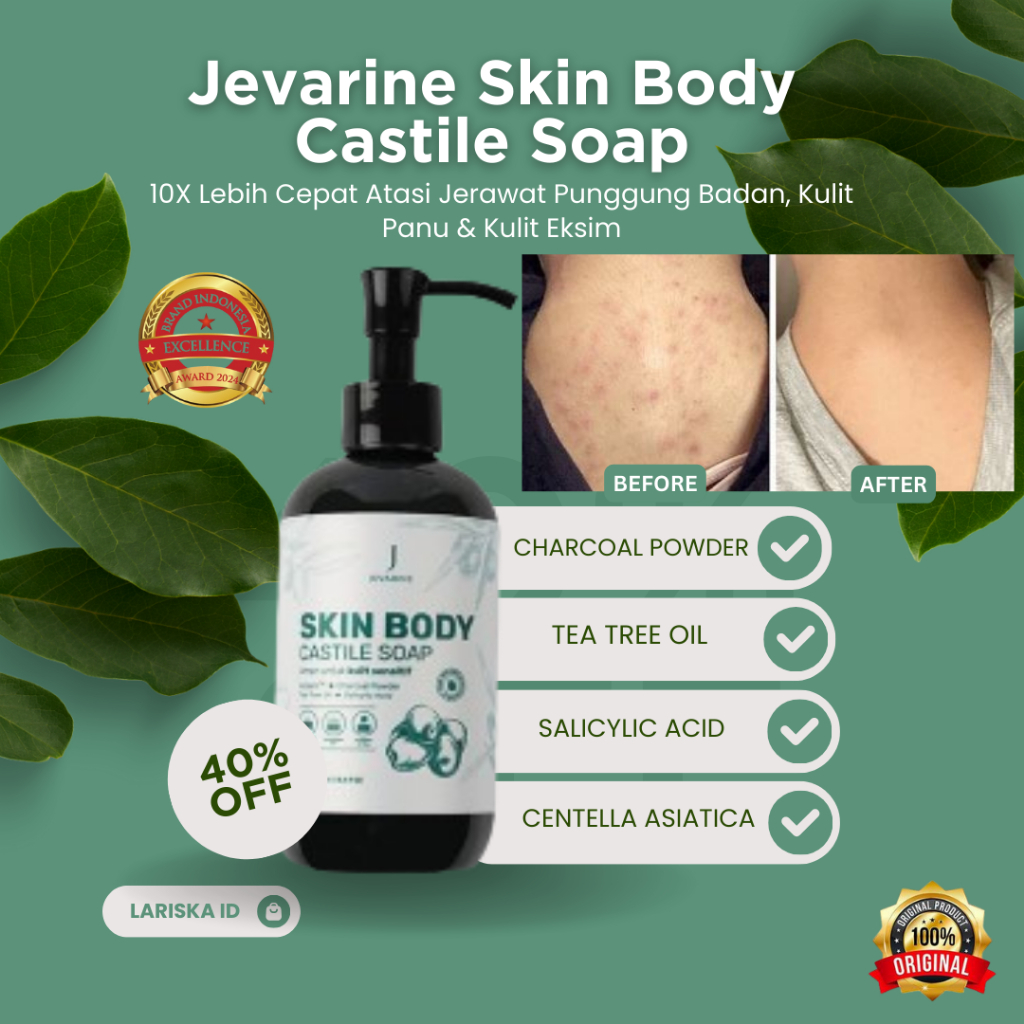 Jual Jevarine Skin Body Castile Soap - sabun jerawat sabun penghilang ...