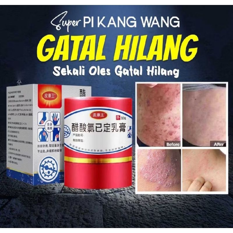 Jual salep pi kang wang super original salep gatal jamur | Shopee Indonesia