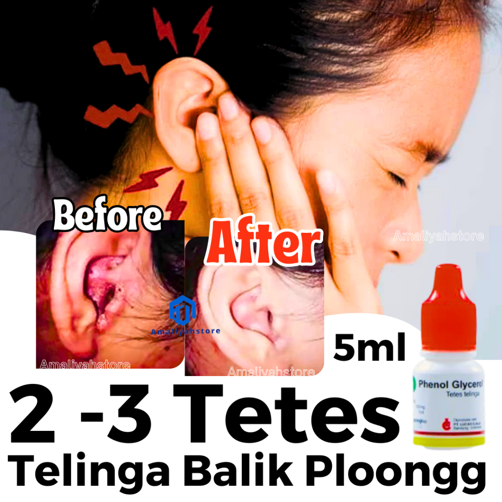 Jual Phenol Glycerol Obat Tetes Telinga Berair Berdenging Berdengung ...