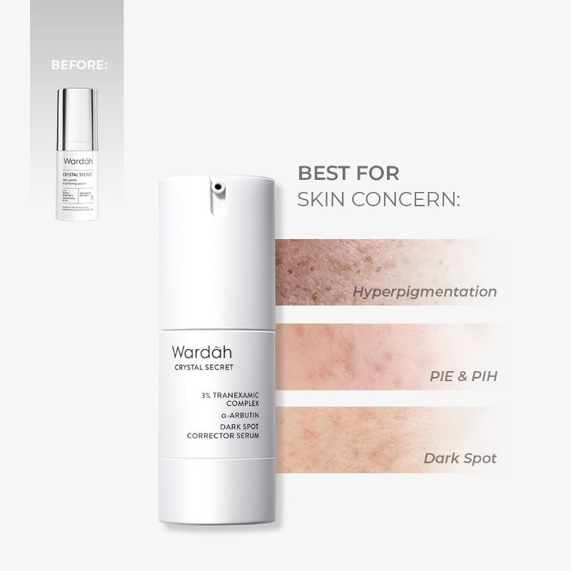 Jual Wardah Crystal Secret Dark spot Corrector Serum 20ml | Shopee ...