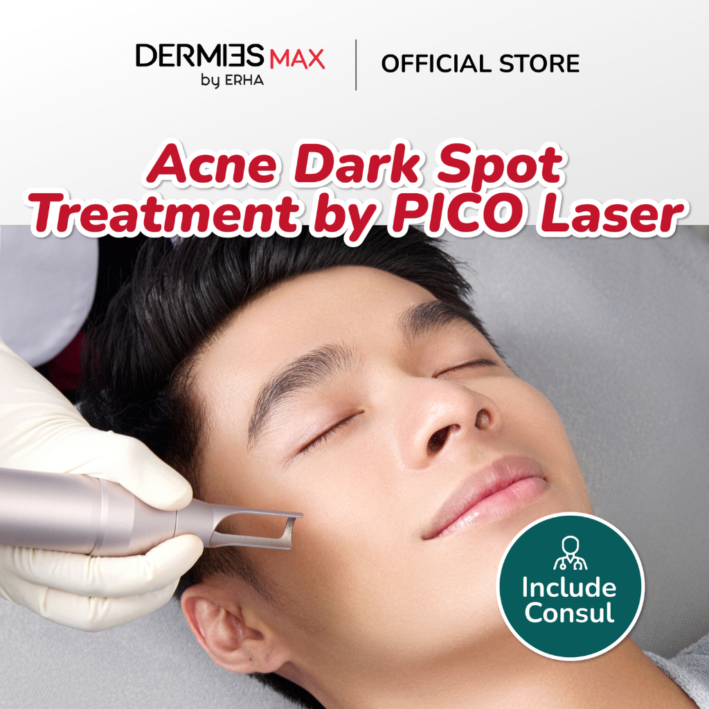 Jual Dermies Max Acne Dark Spot Treatment by PICO Laser | Shopee Indonesia