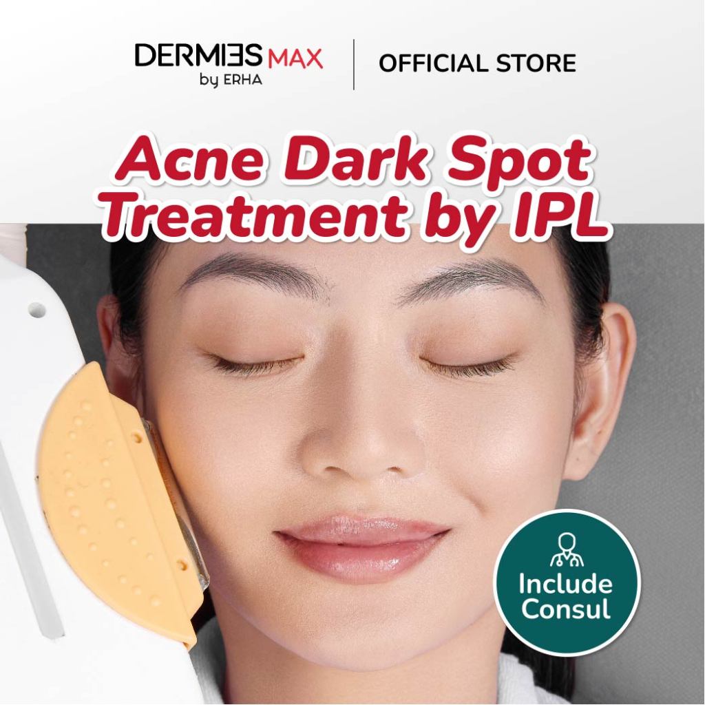 Jual Dermies Max Acne Dark Spot by IPL | Shopee Indonesia