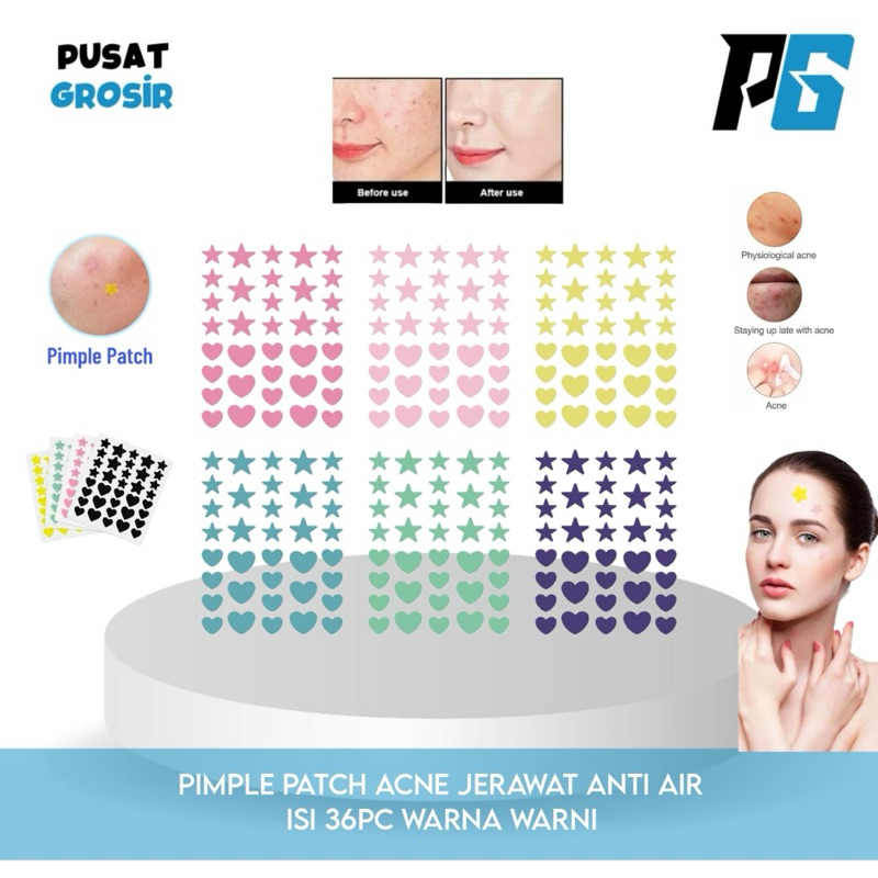 Jual Acne Patch Jerawat Stiker pimple Tempel Motif Star Love | Shopee ...