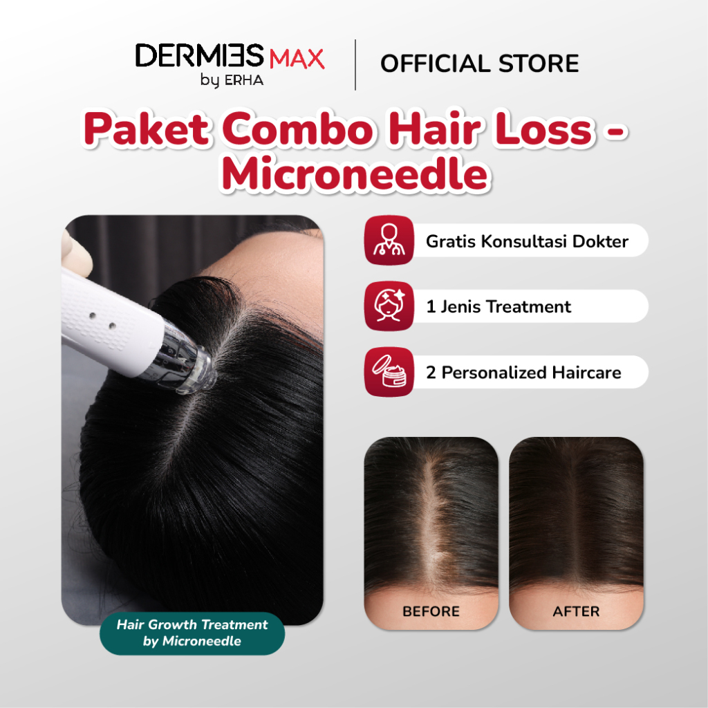 Jual Dermies Max Paket Combo untuk Hair Loss - Microneedle | Shopee ...