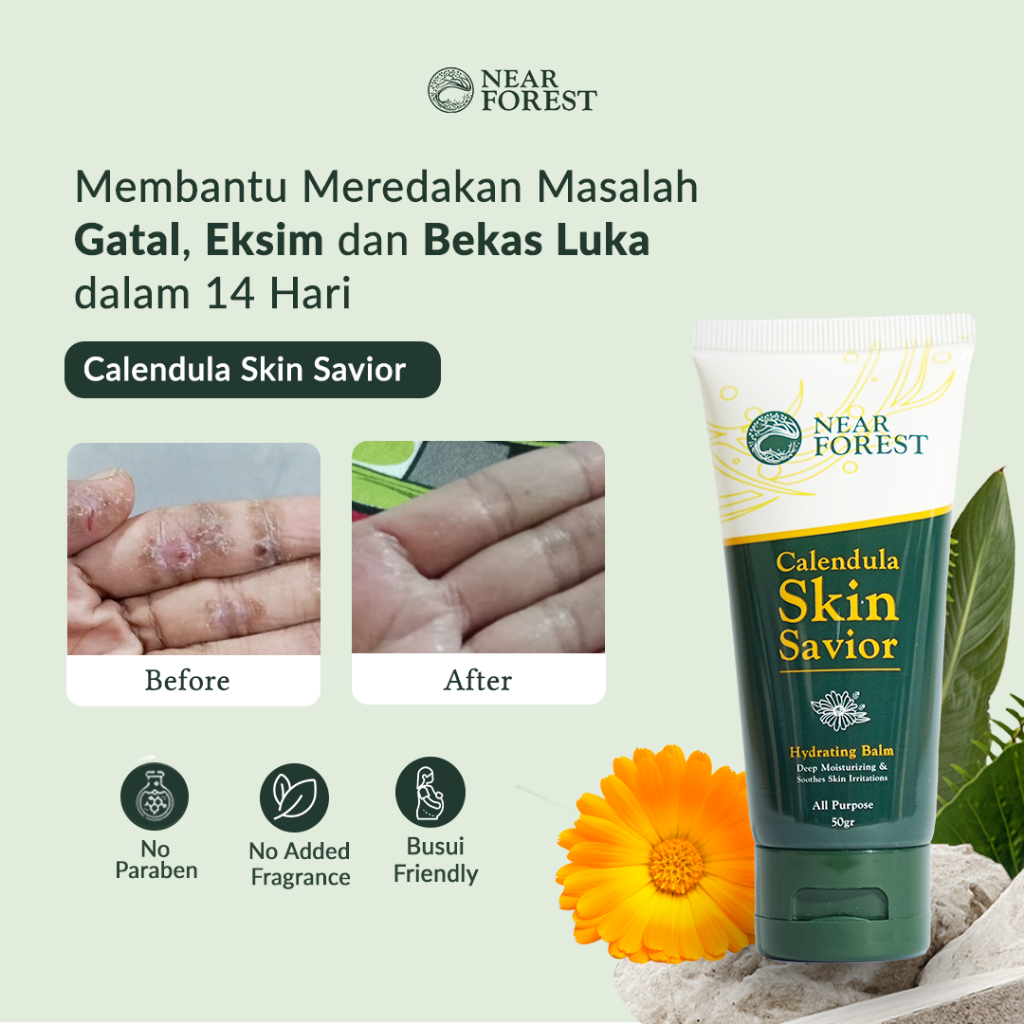 Jual Nearforest Calendula Skin Savior Hydrating Balm Krim Pereda Gatal Eksim dan Kulit Sensitif ...