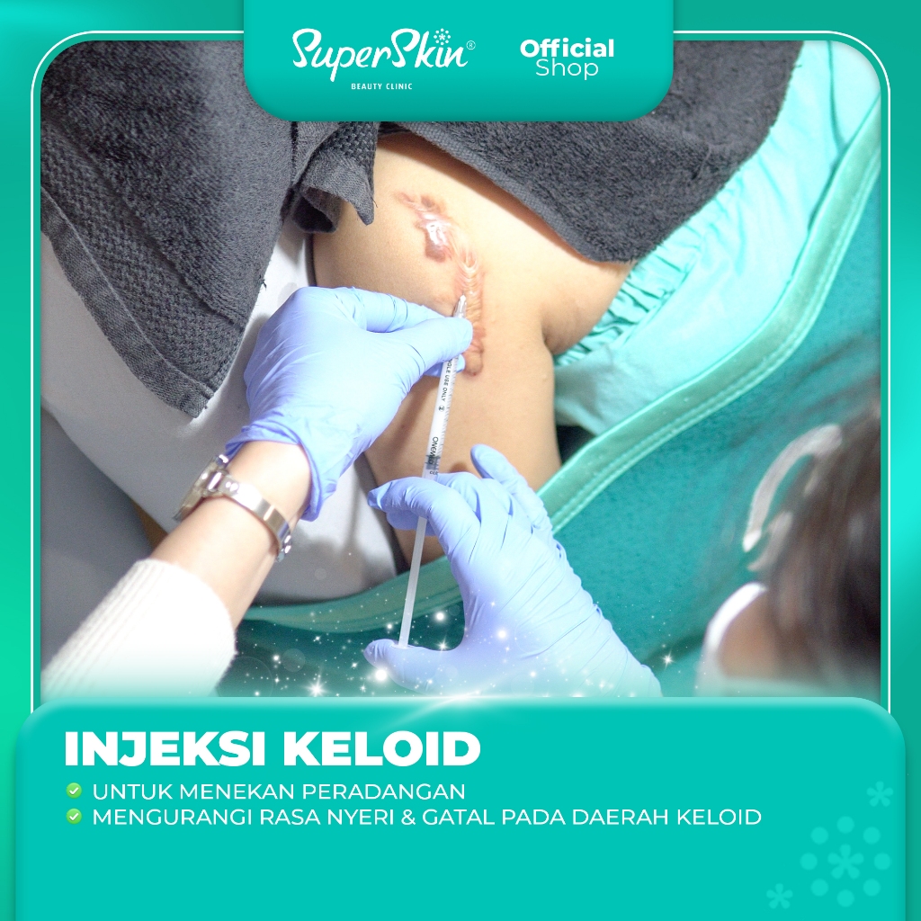 Jual Superskin Injeksi Keloid - Menghilangkan Keloid | Shopee Indonesia