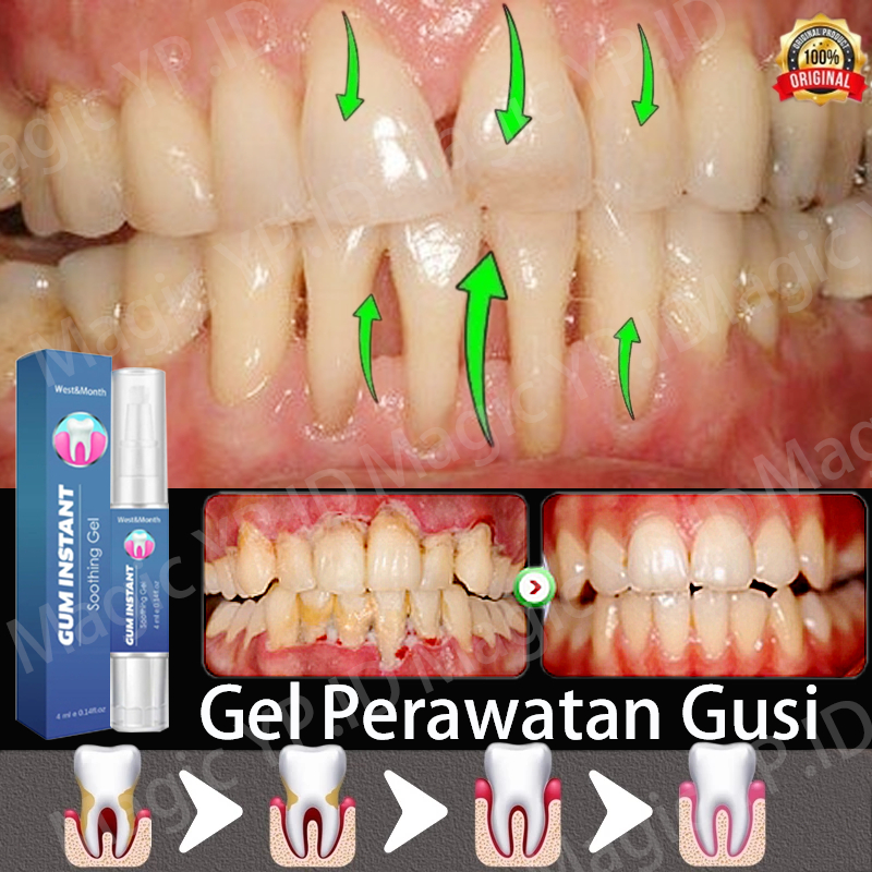 Jual gumshield obat gusi bengkak obat sakit gigi ampuh obat sakit gigi ...