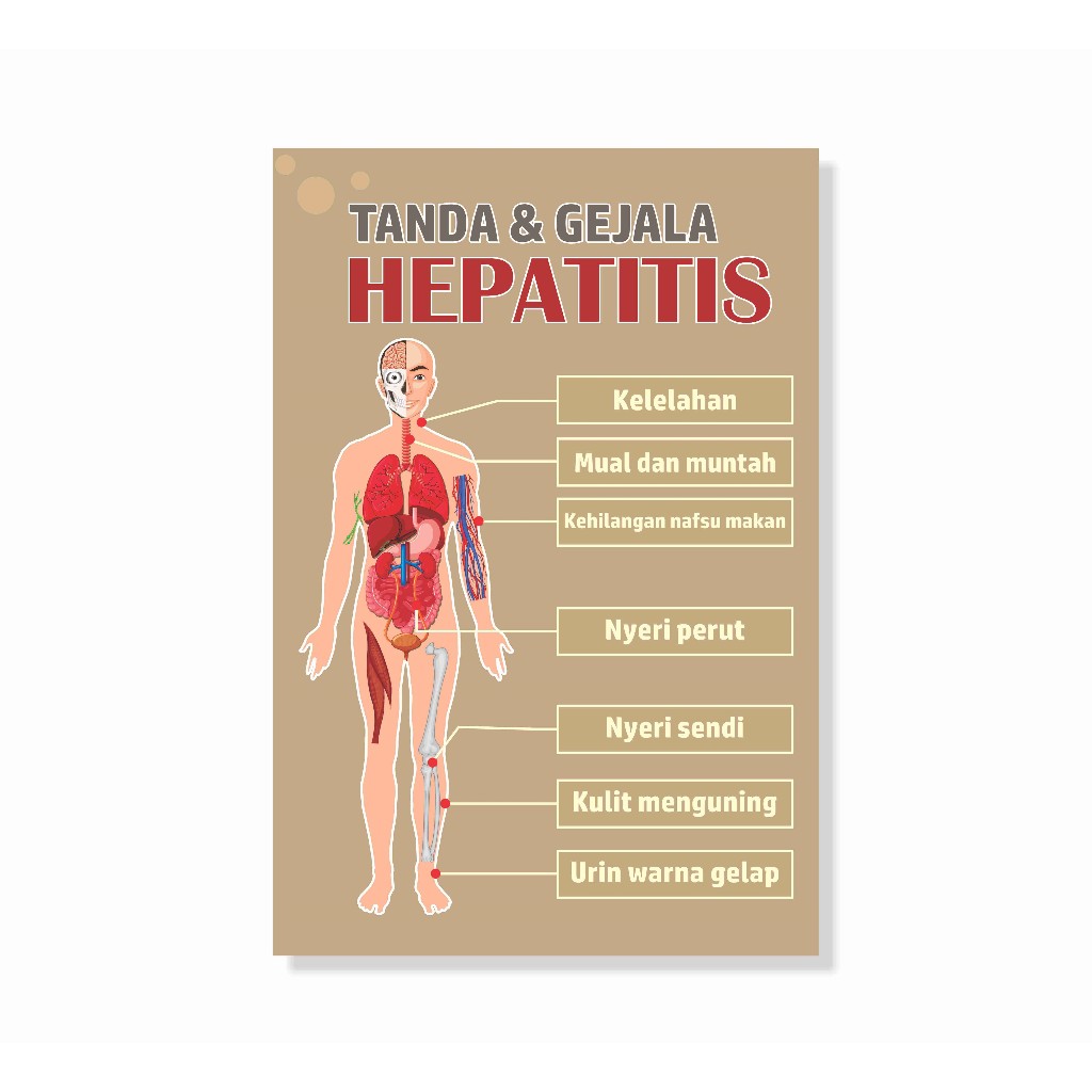 Jual Poster Kesehatan Tanda dan Gejala Hepatitis | Shopee Indonesia