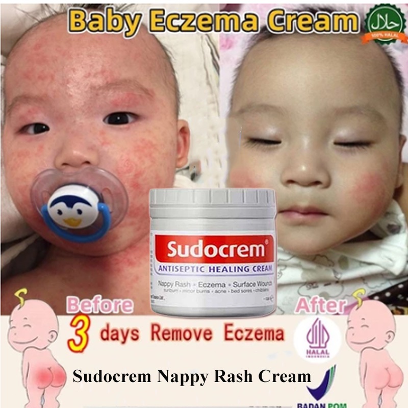 Jual Sudocream Antiseptic Healing Cream 60gr diaper rash baby Sudocream ...