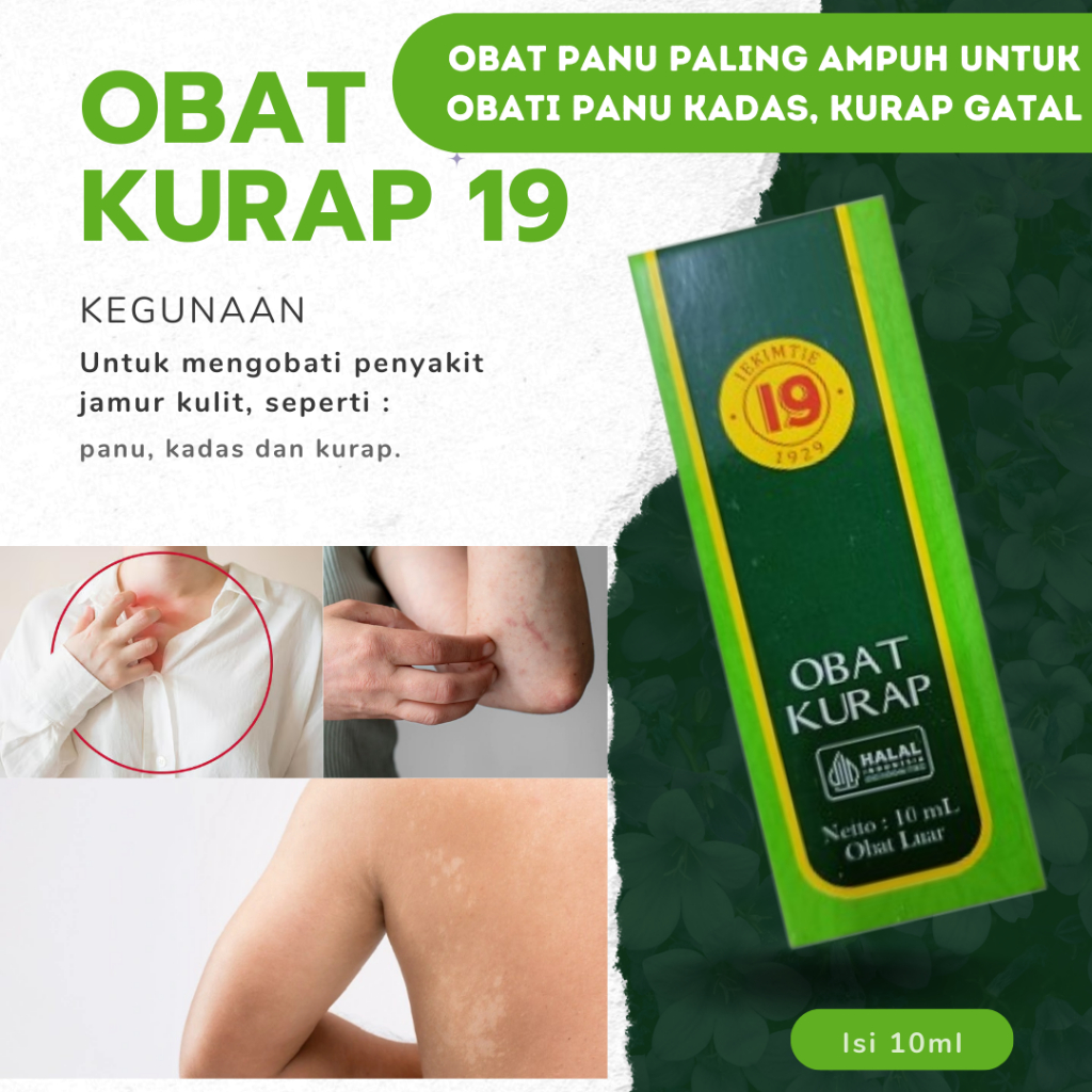 Jual Obat Panu Paling Ampuh untuk Obati Panu Kadas, Kurap Gatal-Gatal ...