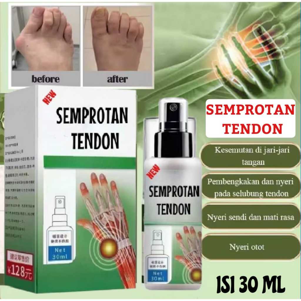 Jual Spray Cold Skin Atasi Sendi Kaki Siku Tulang Tendon Bengkak Nyeri ...