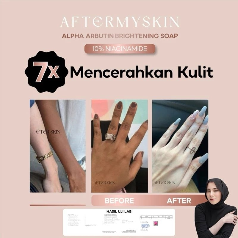 Jual AFTERSKIN - Aftermyskin HB Merah Dosting 3% Alpha Arbutin Body Gel ...