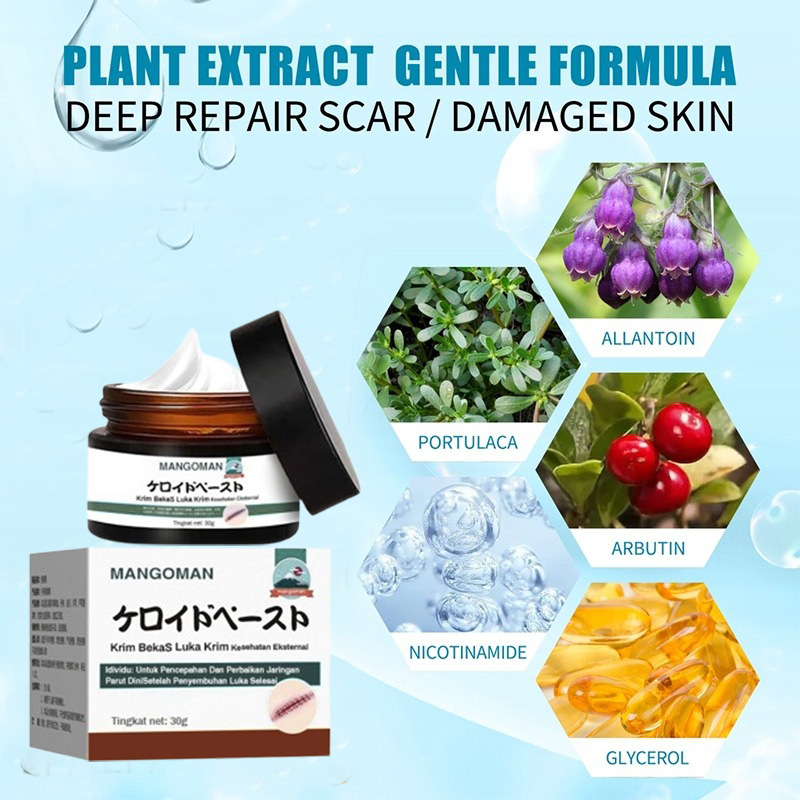 Jual Penghilang bekas luka scar cream external health cream 30g ...