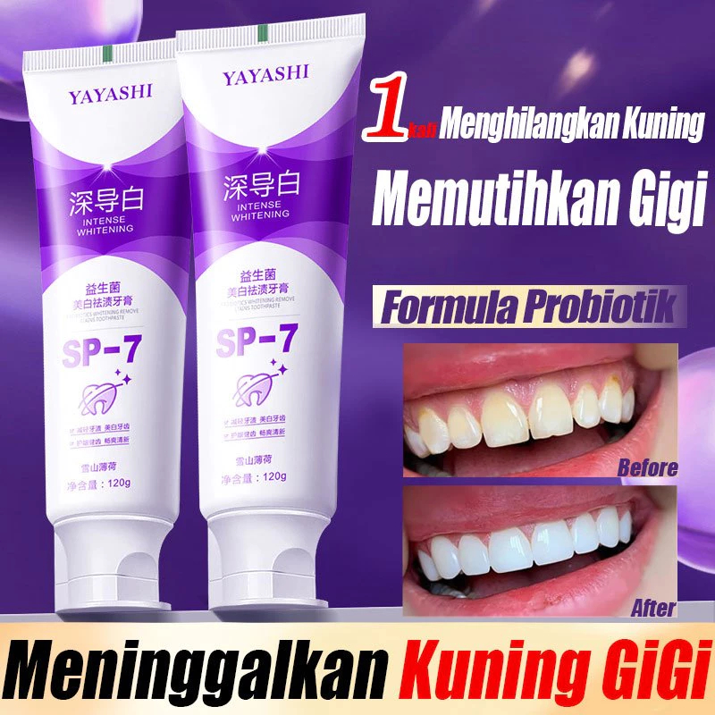 Jual SP-7 120g Pasta Gigi Pemutih Gigi Kuning Probiotik Memutihkan Gigi ...