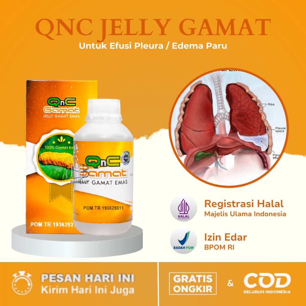 Jual [BEST SELLER] Obat Efusi Pleura, Obat Penumpukan Cairan Di Paru ...