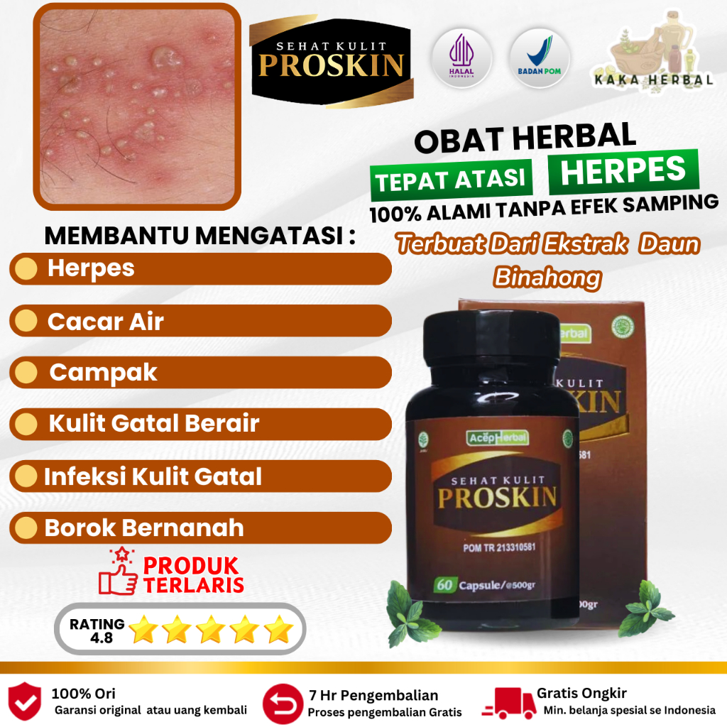 Jual Kaka Herbal - Obat Herpes Kulit, Obat Herpes Genital, Obat Herpes ...