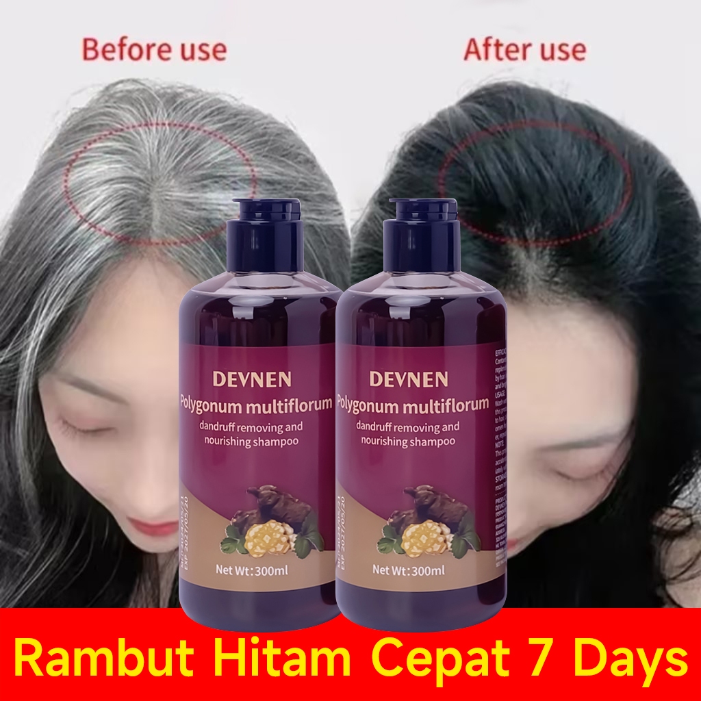 Jual Shampoo Penghitam 300ml Rambut Shampo Uban Permanen Original ...