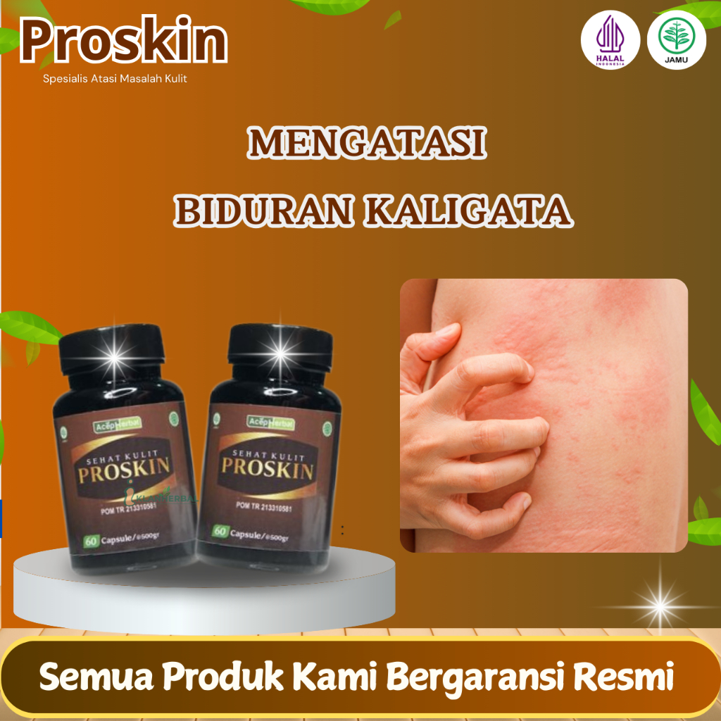Jual Obat Biduran Kaligata Bentol Bintik Merah Ruam Kulit Dengan ...