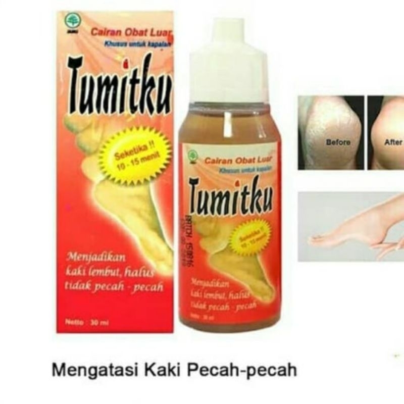 Jual Tumitku Obat Herbal Kaki Pecah dan Kering | Shopee Indonesia