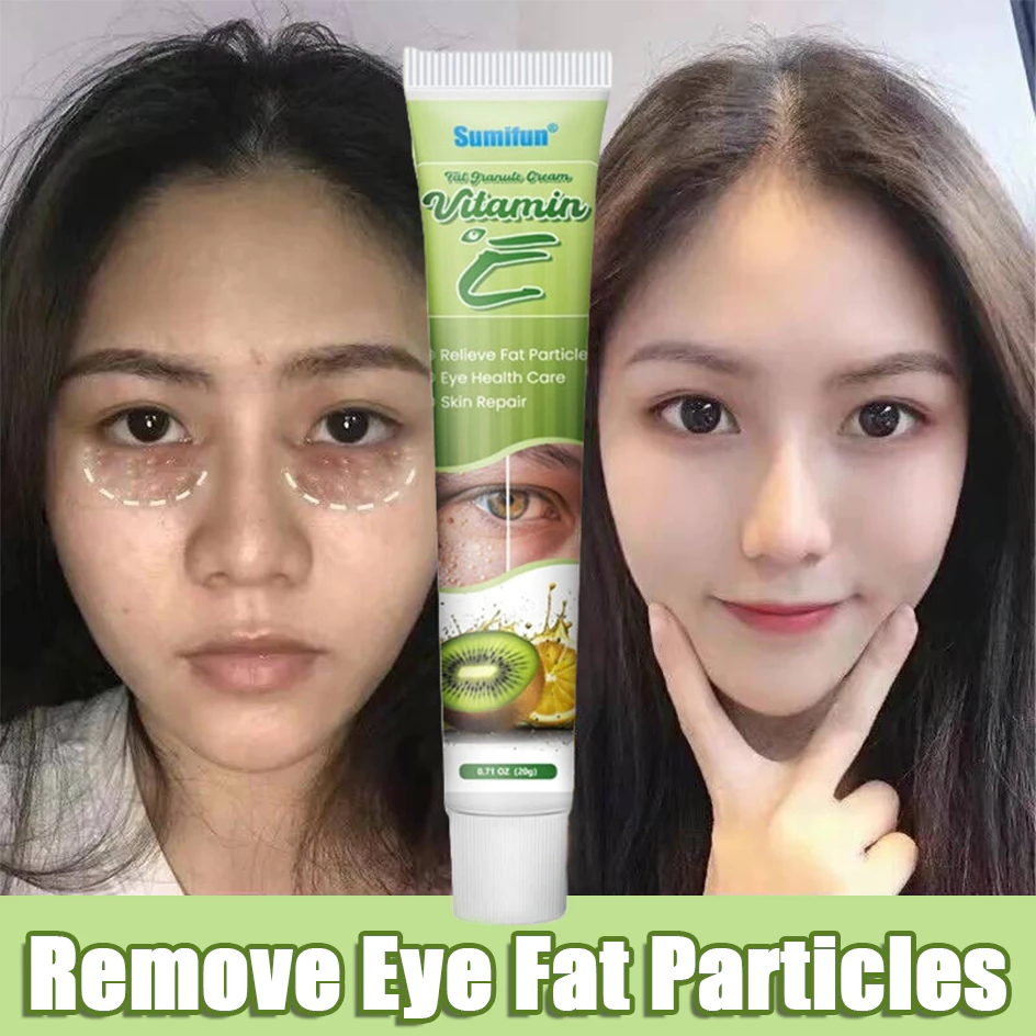 Jual Milia di bawah mata 20g Penghilang milia Eye cream obat milia ...