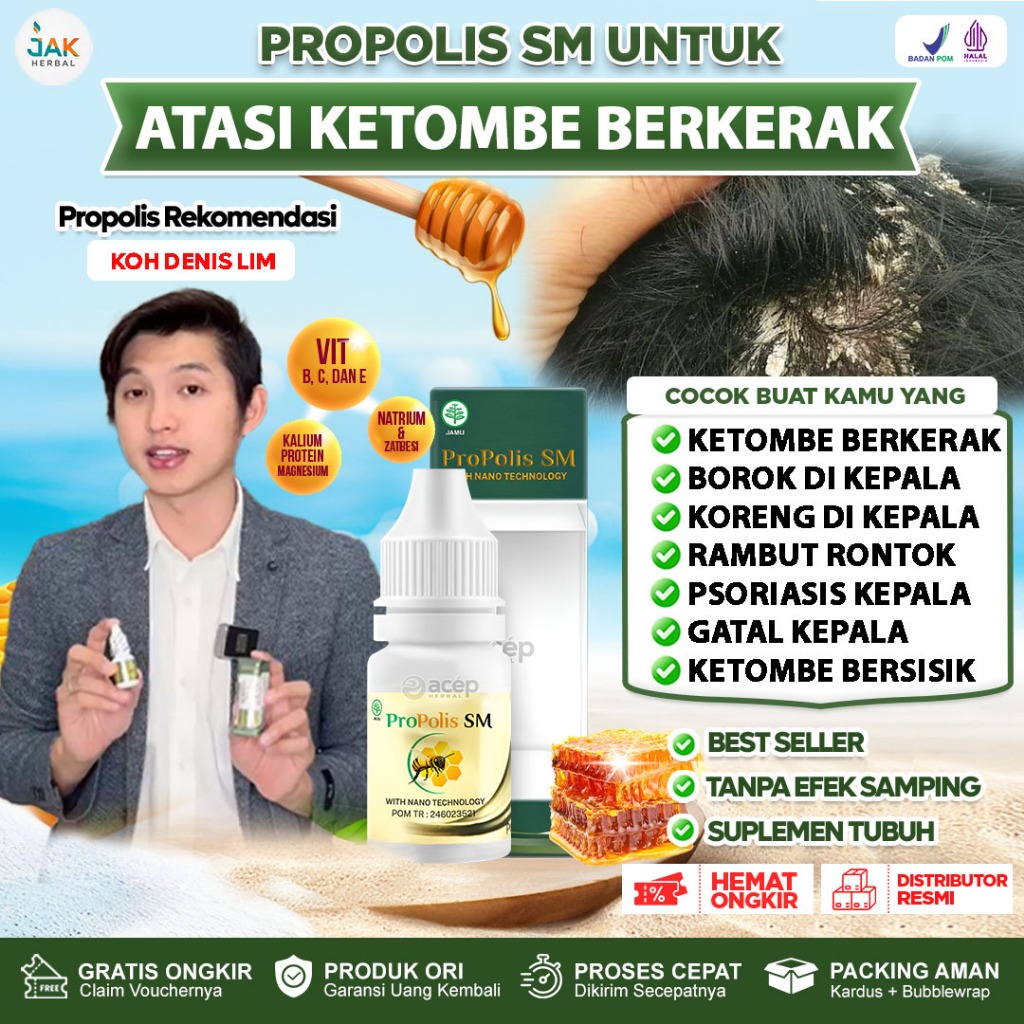 Jual Obat Oles Gatal Di Kulit Kepala Ketombe Berkerkerak Borok Bernanah Rontok Tinea Capitis ...