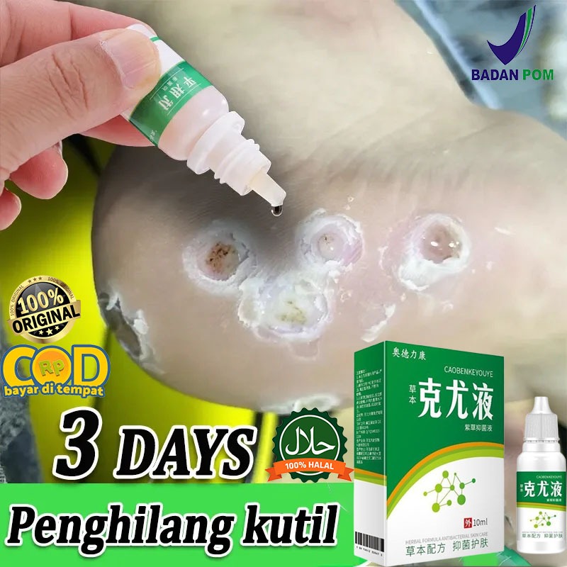 Jual Obat mata ikan Obat penghilang tahi lalat Kutil obat kutil Plester ...