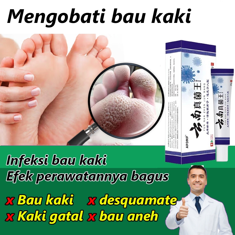 Jual Obat Kaki Rayapan Dan Bau Salep Kaki Obat Gatal Penghilang Bau Kaki Krim Rayapan Telapak ...