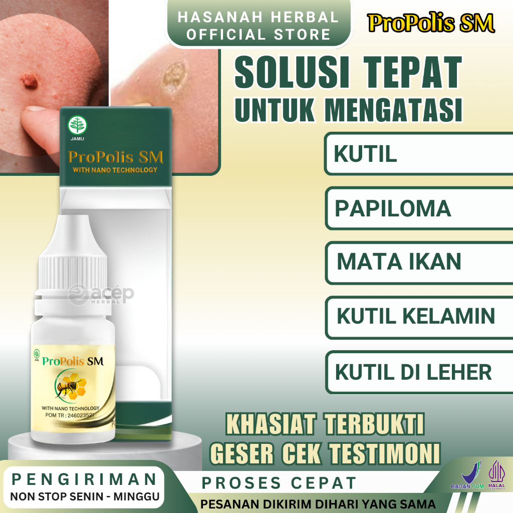 Jual Obat Penghilang Kutil Mata Ikan Atasi Kutil Kelamain dan Papiloma ...