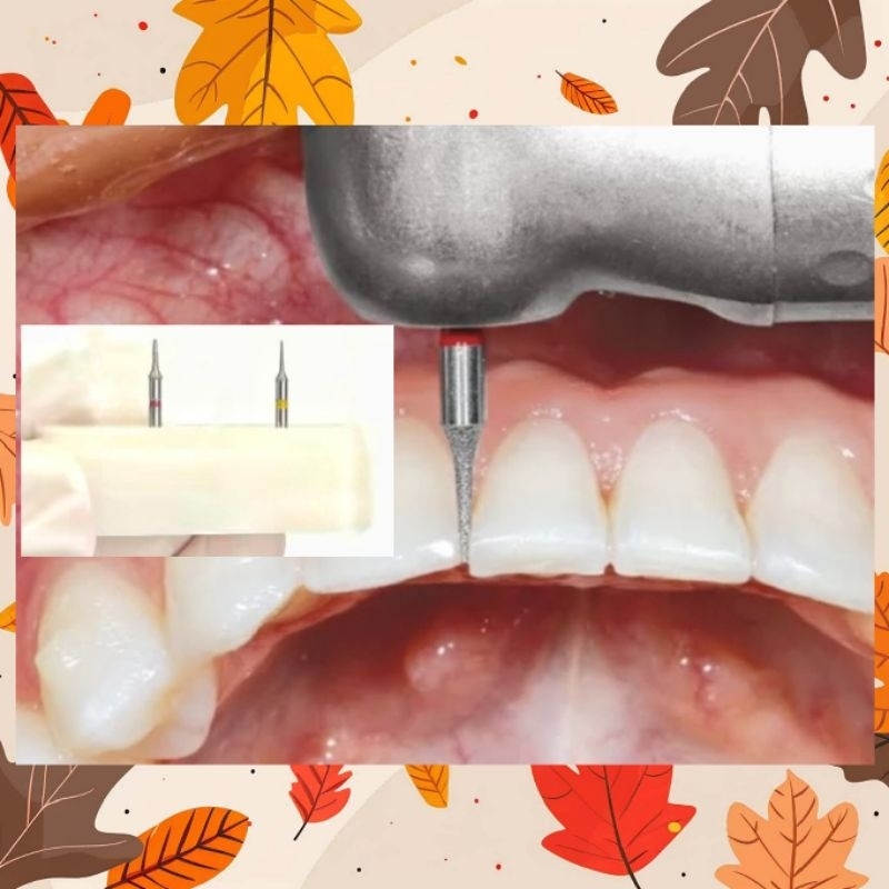 Jual Dental Ortho Mosquito Diamond Bur Slicing Opening Proximal Space ...