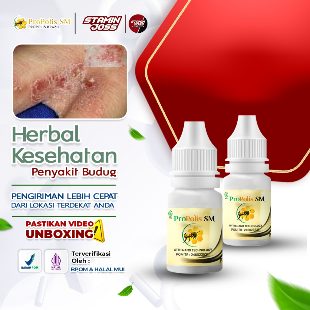 Jual Obat Budug Gudig Obat Oles Kutu Air Infeksi Jamur Herpes Kulit ...