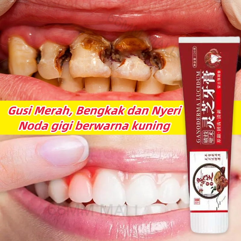 Jual Pasta Gigi Ganoderma Pasta Gigi Non Fluoride 120g Gusi Bengkak ...