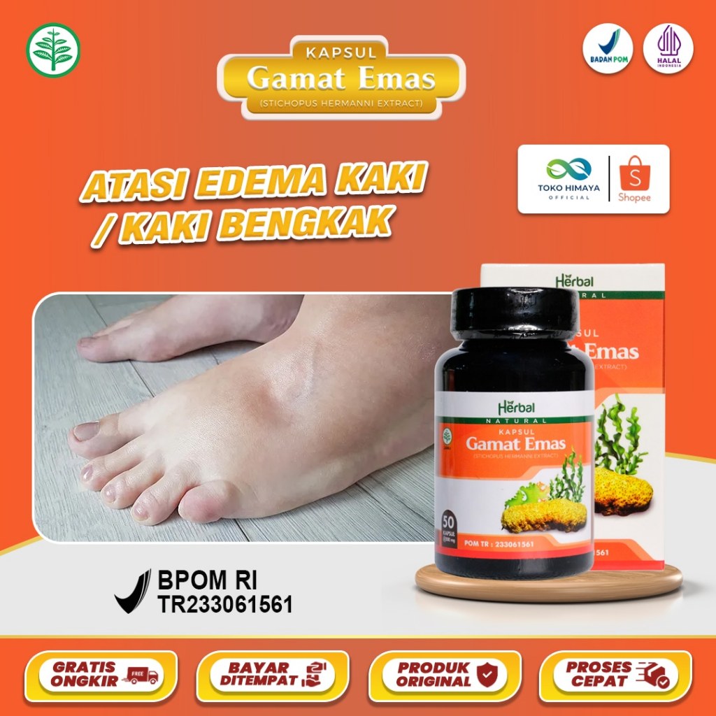 Jual Obat Untuk Kaki Bengkak, Edema Kaki / Penumpukan Cairan Di Kaki ...