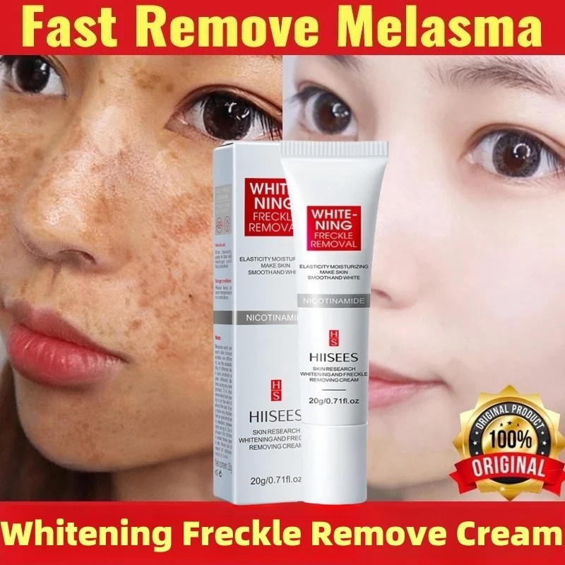 Jual Whitening Freckle Cream Remove Dark Spots Anti Freckle Face Creams Niacinamide Fade ...